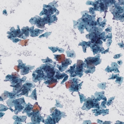 Conventional Paps Study Set - MGH Learn Pathology