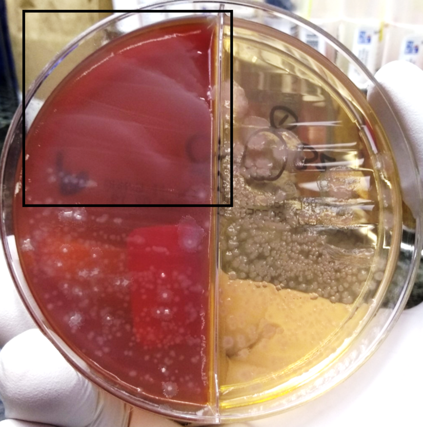 Gram Negative Proteus Mirabilis